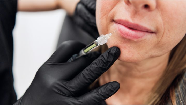 How Long Does It Take To Recover From Plastic Surgery? - Yazdani Aesthetics