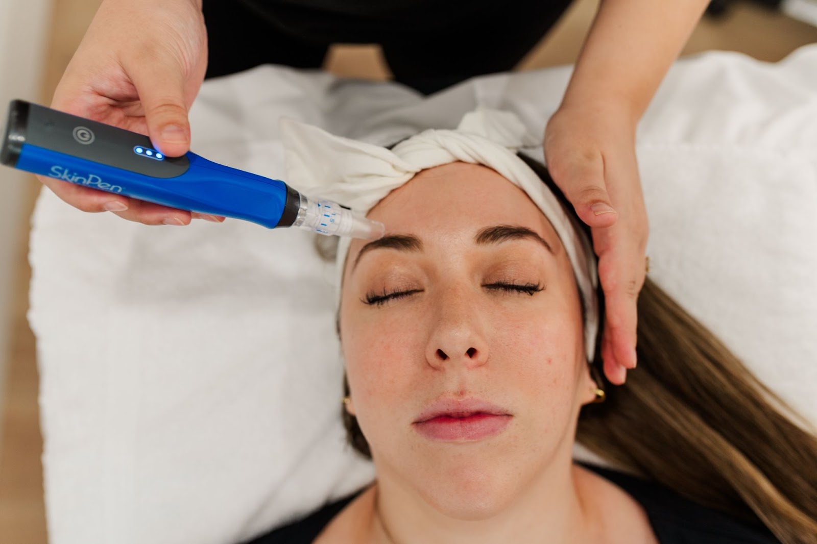 How Long Does Microneedling Last? | Yazdani Aesthetics