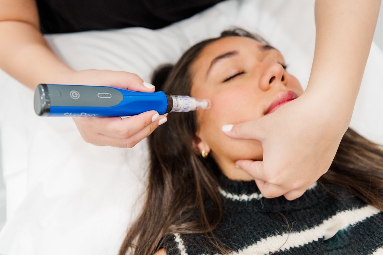 How Long Does Microneedling Last? | Yazdani Aesthetics